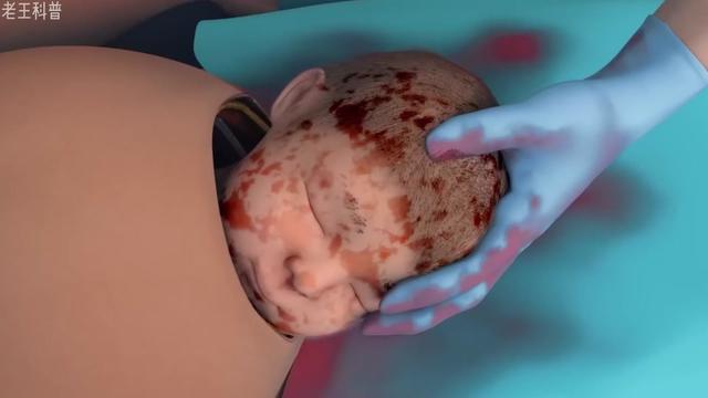 顺产有多痛苦、这个视频带您了解分娩过程! #顺产 #分娩#科普