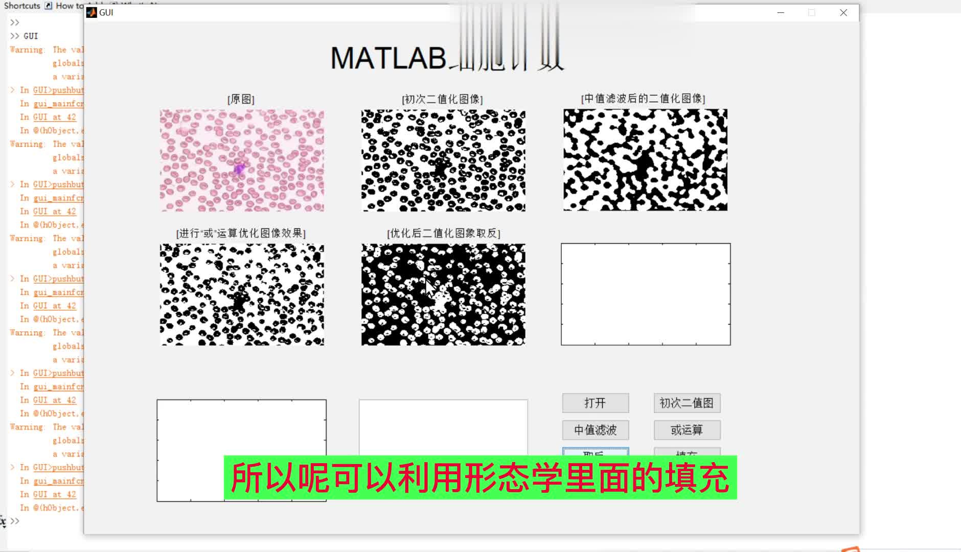 MATLAB细胞计数系统GUI设计。带界面设计