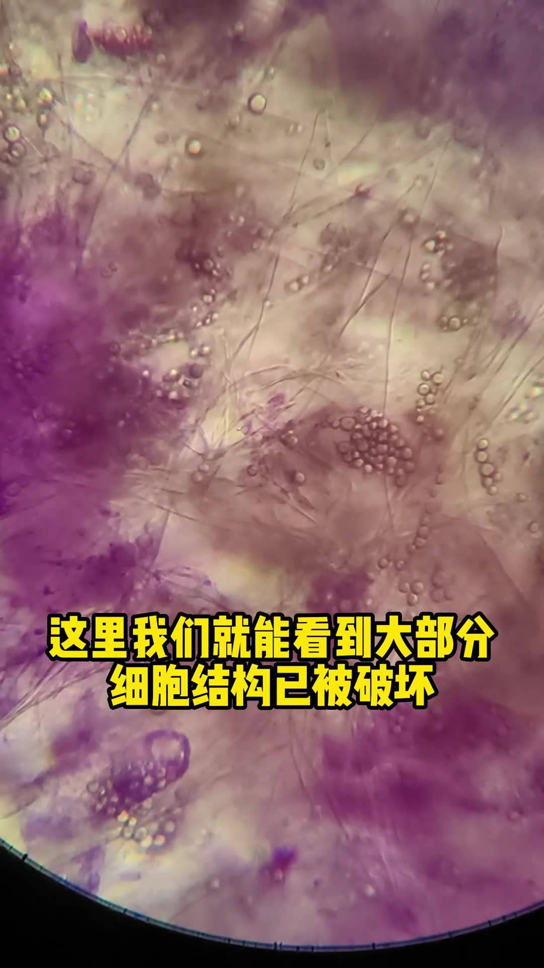 冻梨真的能吃么?