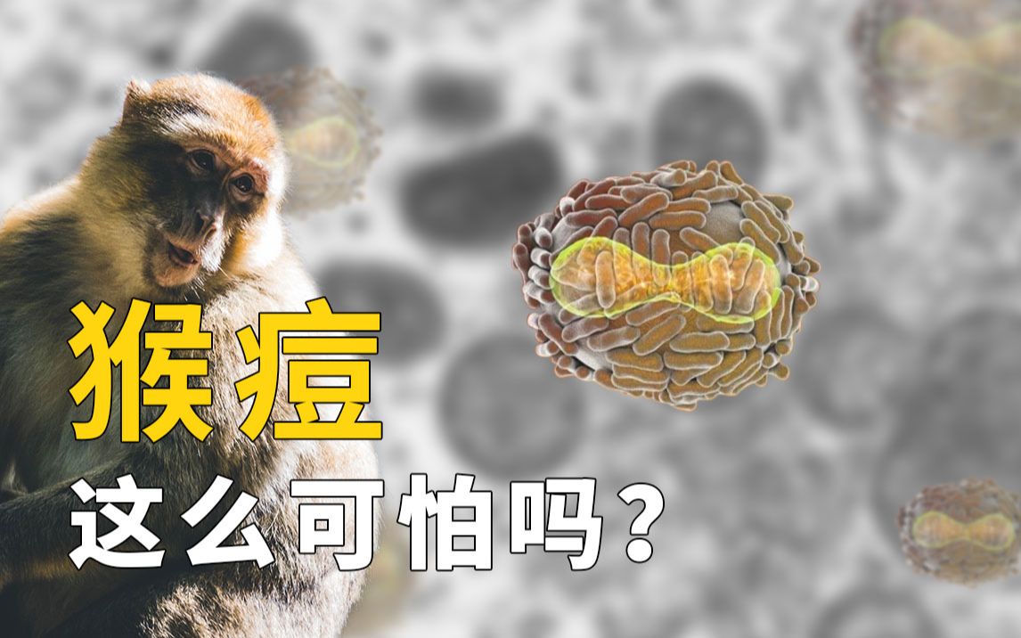 我们中国人需要担心猴痘吗?三分钟带你了解猴痘!