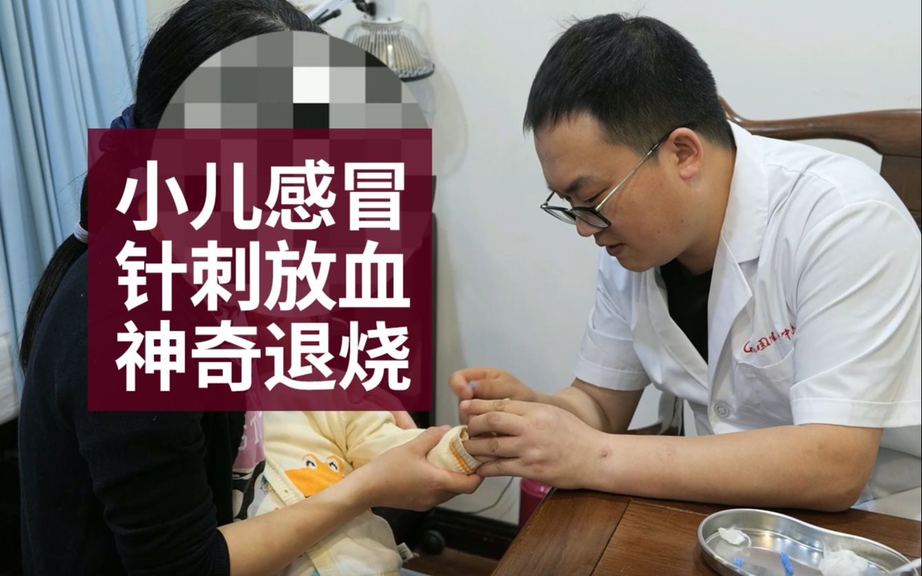 针灸实战:小儿感冒针刺手指穴位放血,神奇退烧