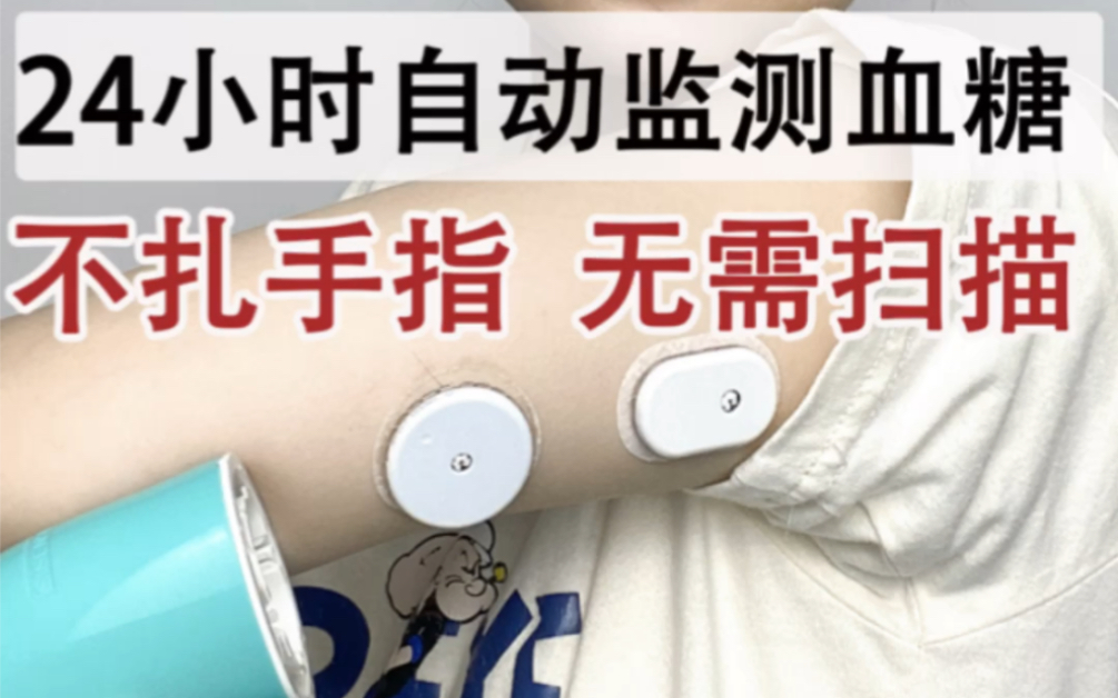 动态血糖仪怎么选?硅基还是雅培?看完就不纠结了