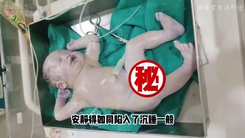 新生儿诞生之际却面临生命危机,这背后的真相令人心痛