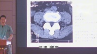 腰椎CT分析知识点之椎间盘肾形凹陷特征