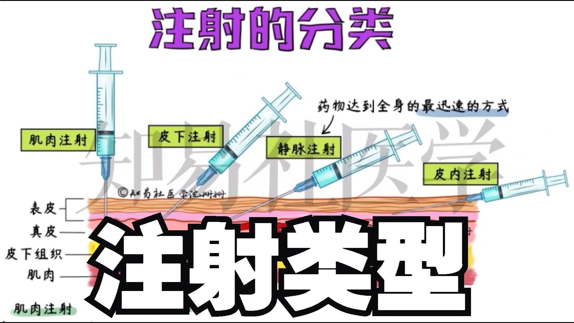 医学手绘动画 注射类型(皮下 皮内 肌肉 静脉)