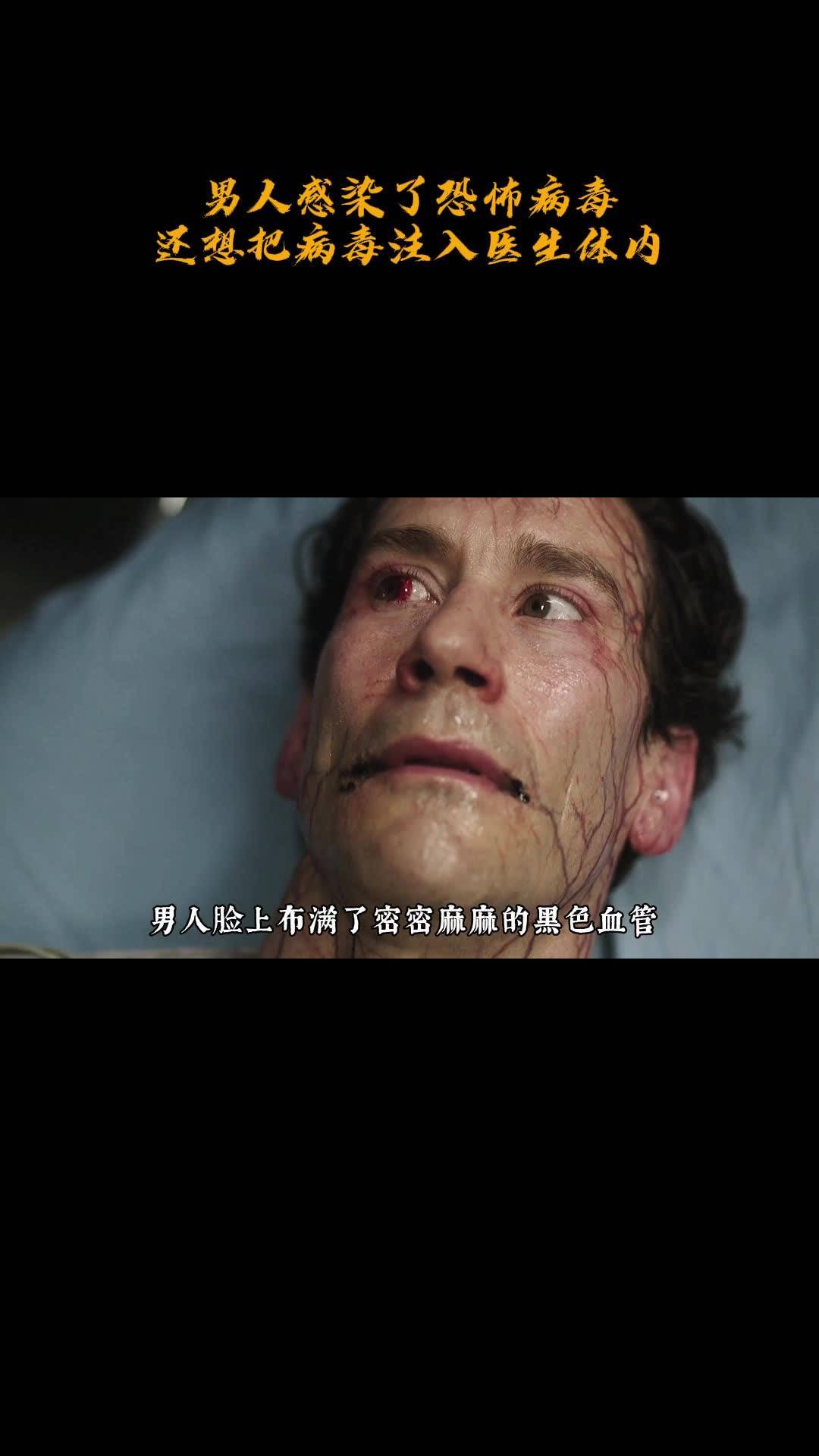 男人感染了恐怖病毒,还想把病毒注入医生体内