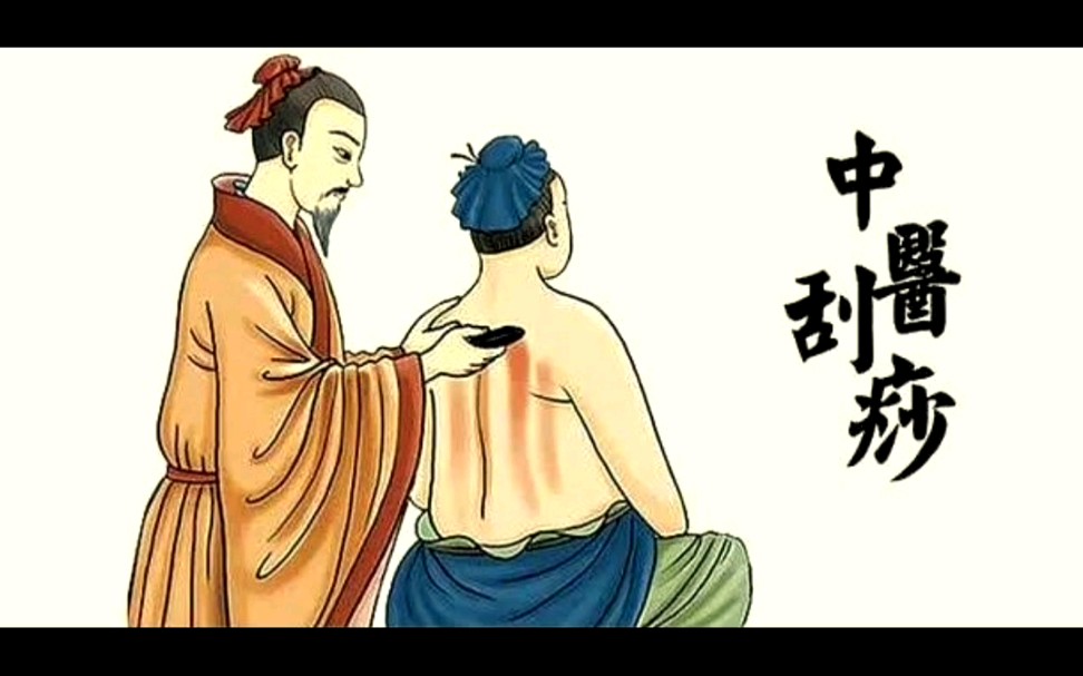 中医刮痧疗法