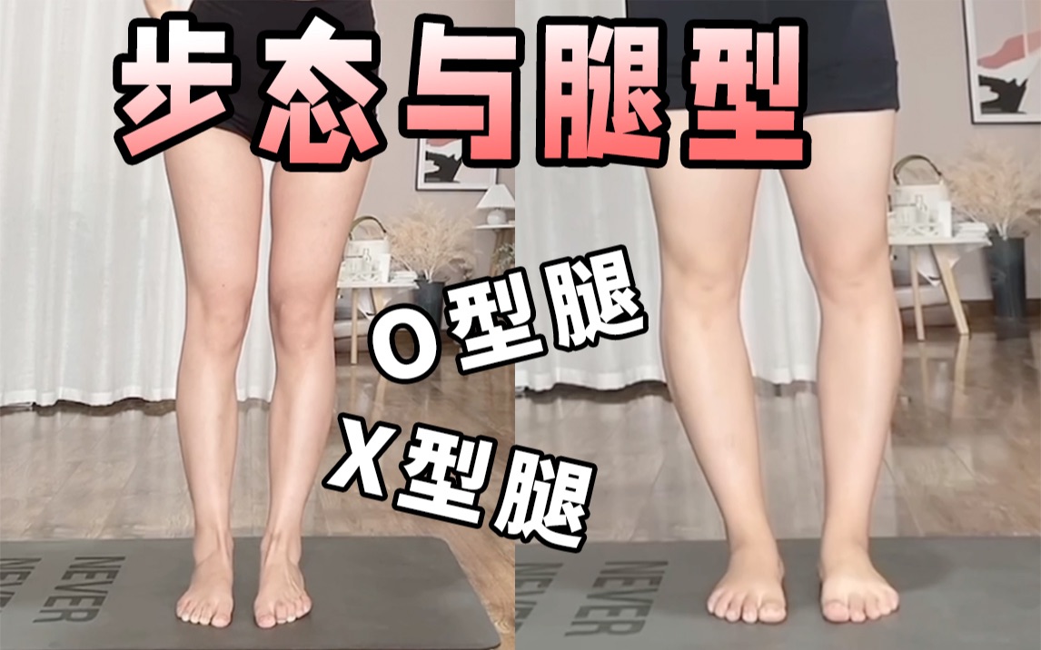 『常见走路姿势盘点』步态与腿型|髋膝踝的联动
