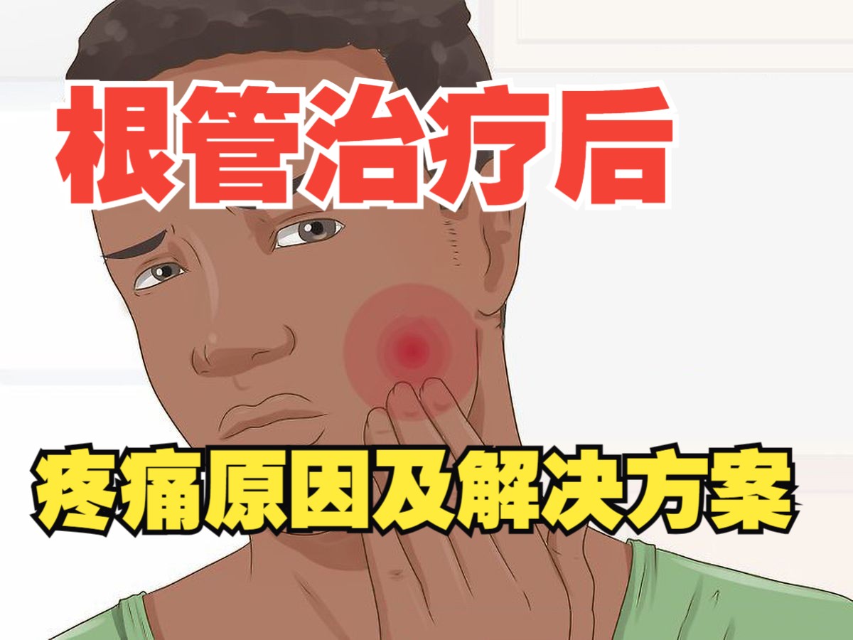 根管治疗之后牙齿又疼了是怎么回事?根管治疗完成后疼痛原因及解决...