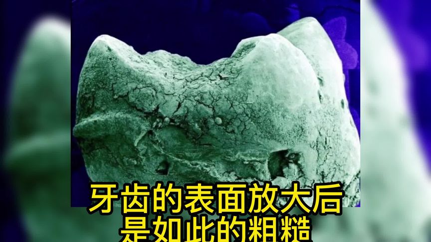 人体表面细菌在#显微镜 放大500倍的样子