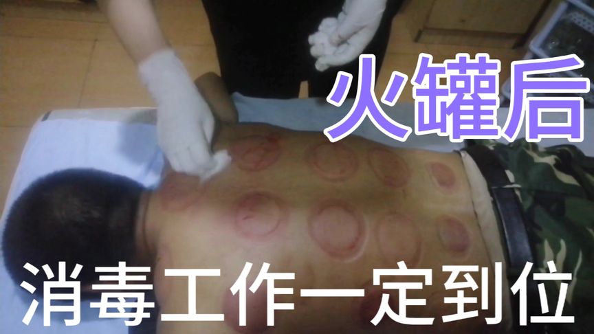 拔火罐还是拔血罐,消毒工作一定到位,不然会发痒过敏溃烂
