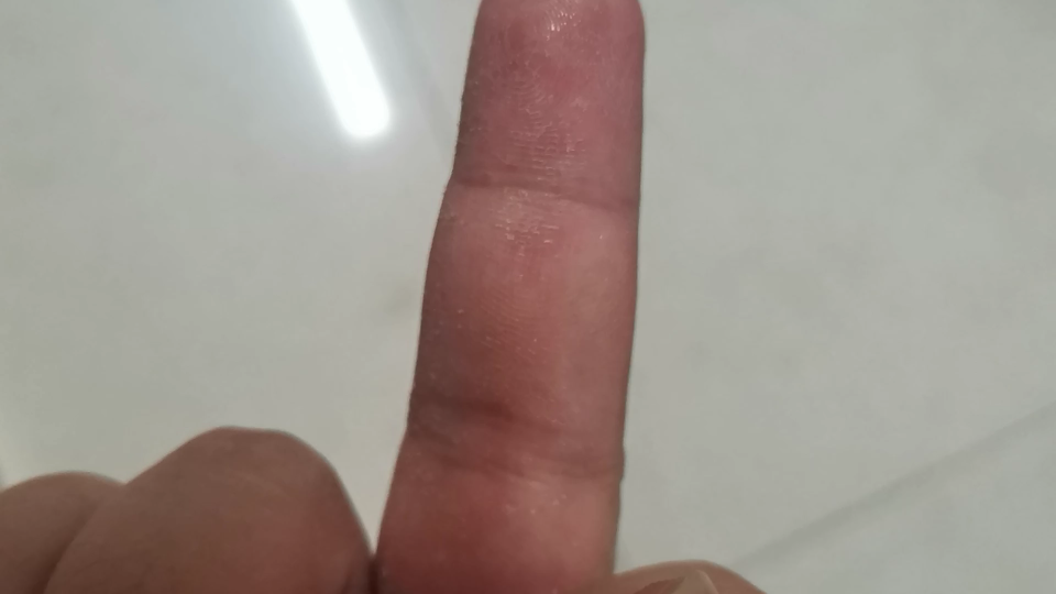 做实验一定要注意保护好自己