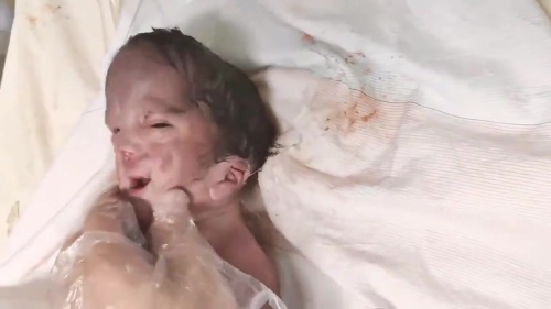 宝宝成长背后的感人历程:年长母亲不屈不挠的爱与决心