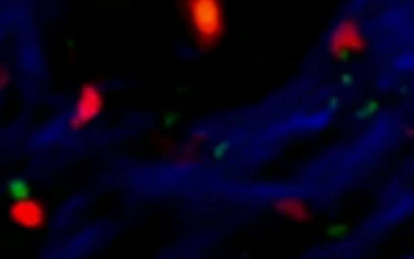 中性粒细胞引导T细胞进行免疫攻击