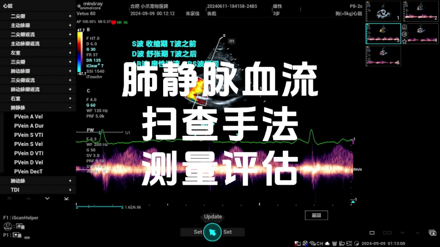 ...但我们扫心超时总是会无意识漏掉这个不常用的指标,做了个视频和...