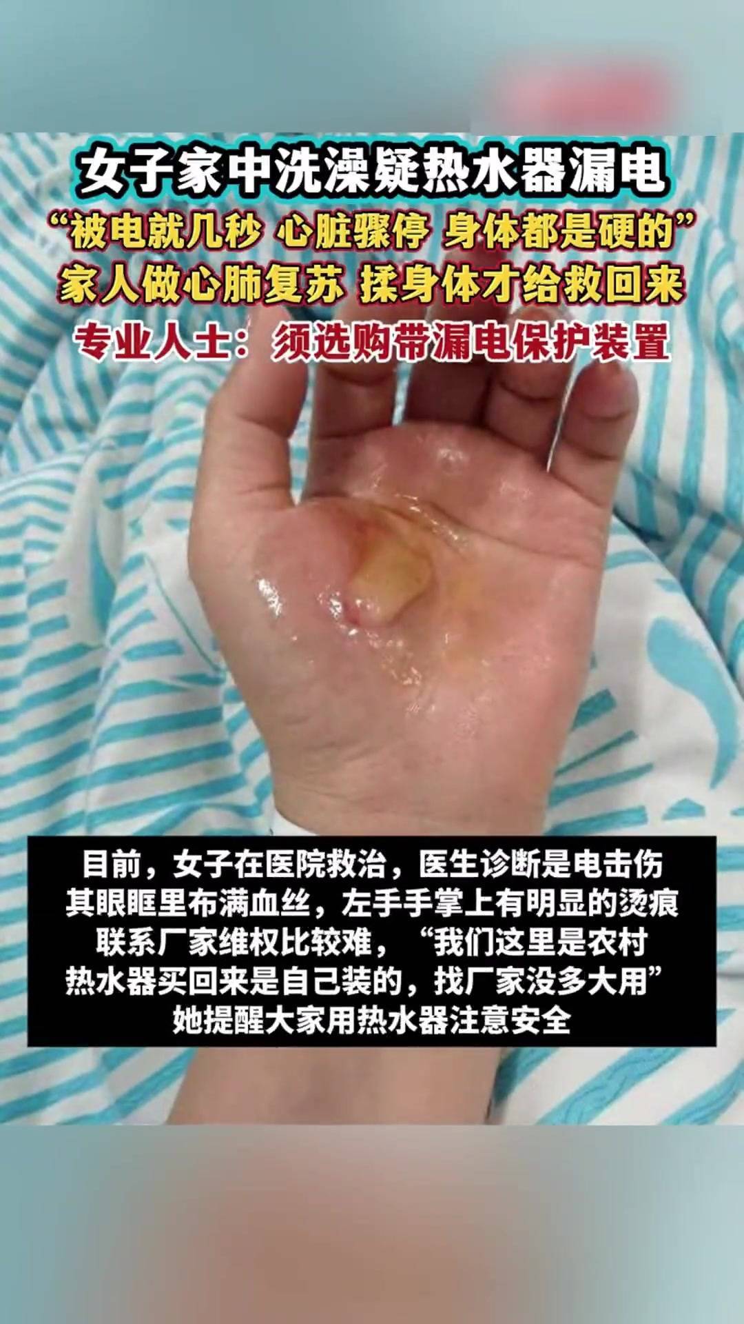 ...热水器疑漏电,家人做心脏复苏救回,专业人士:须选购带漏电保护装置