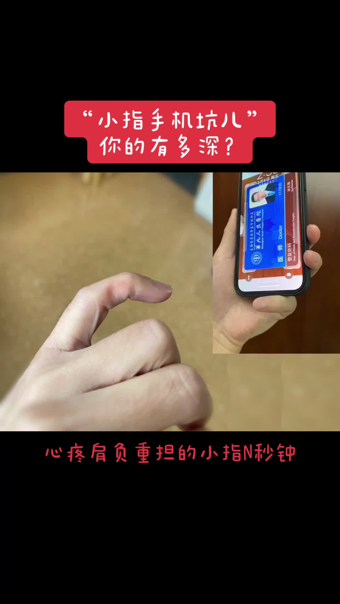 拯救“小指手机坑儿”,你的有多深?ߌ�ߎ� #手机 #手指 #拿手机的...