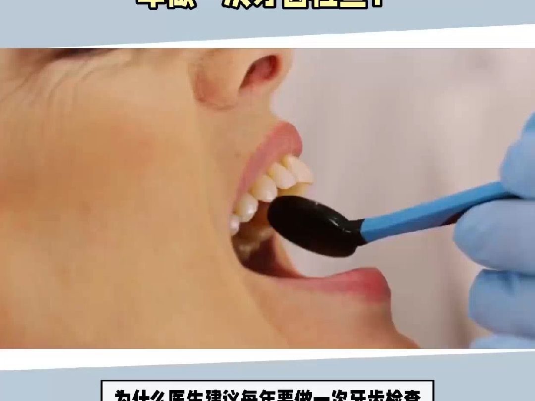 医生为什么建议每年做一次牙齿检查?