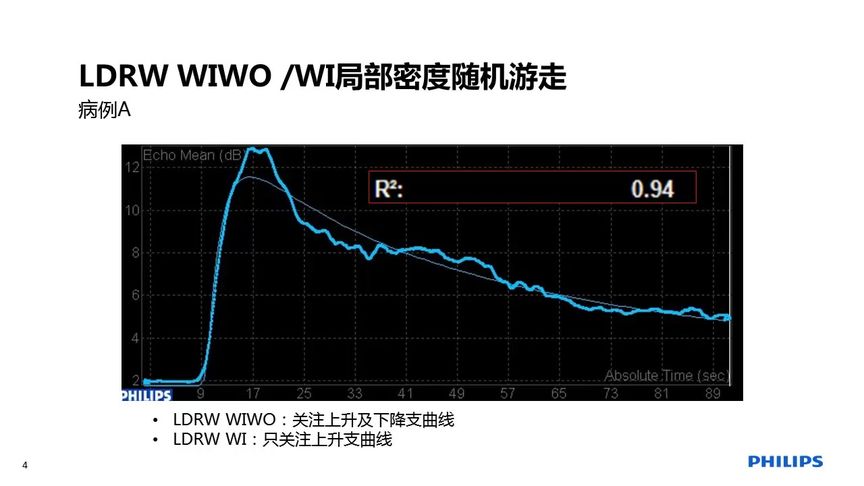 超声技术-介入及术中-超声造影-ROI拟合曲线如何选择