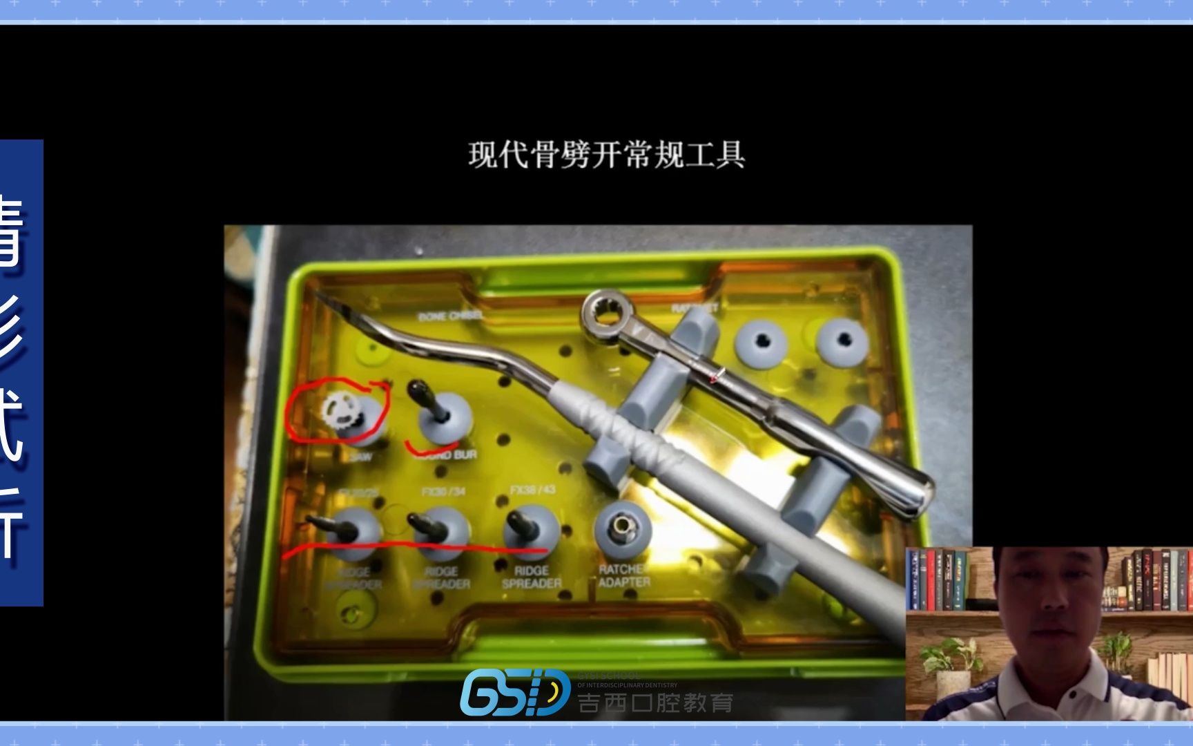 种植牙医学习:骨劈开的应用技巧
