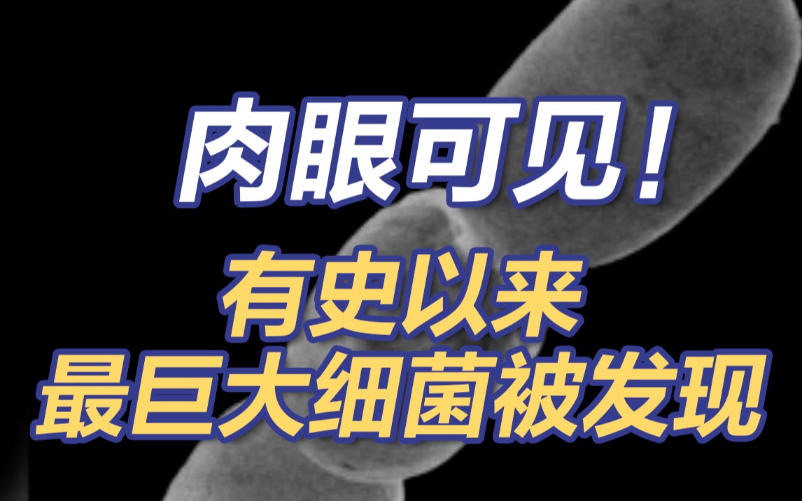 颠覆!肉眼可见的巨型细菌现身,长度2厘米!