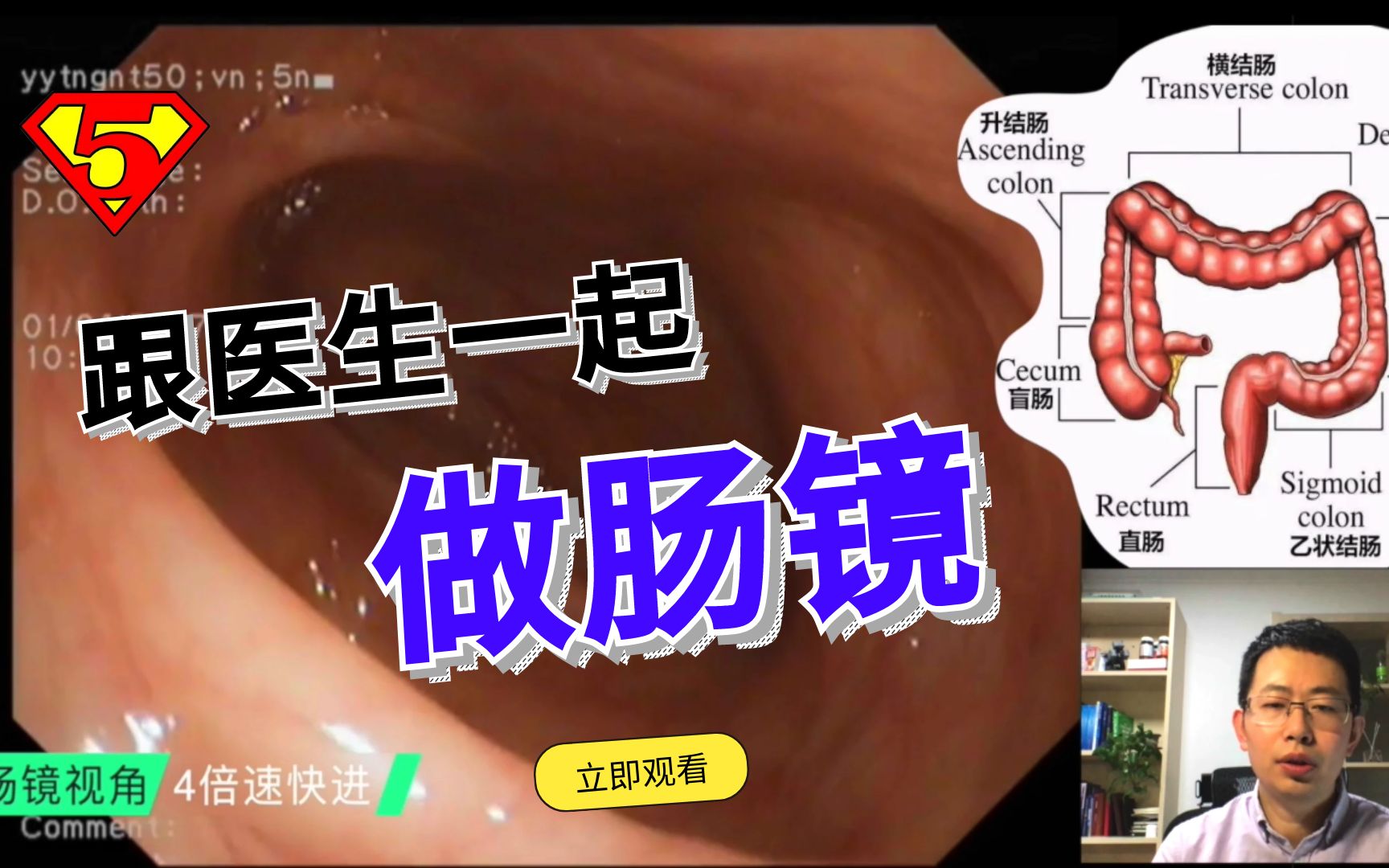 肠镜是怎么做的?第一视角带你解读检查全过程