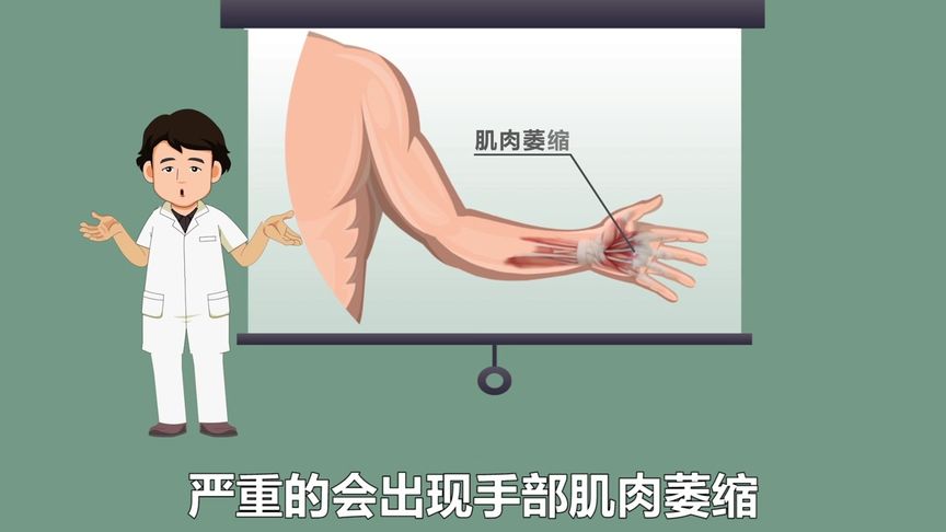 手臂振动病:这些行业工作者要小心这种不可逆伤害!