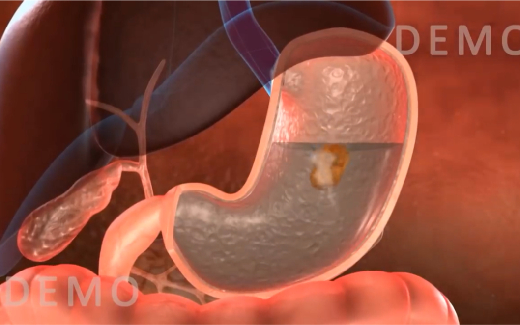 【生物学】3D演示-食物在胃部消化的过程
