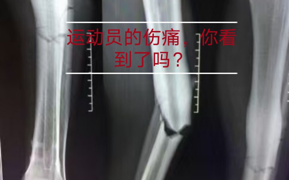 运动员和体育爱好者,请看完这个视频,评论区留下您的宝贵意见,已申请...