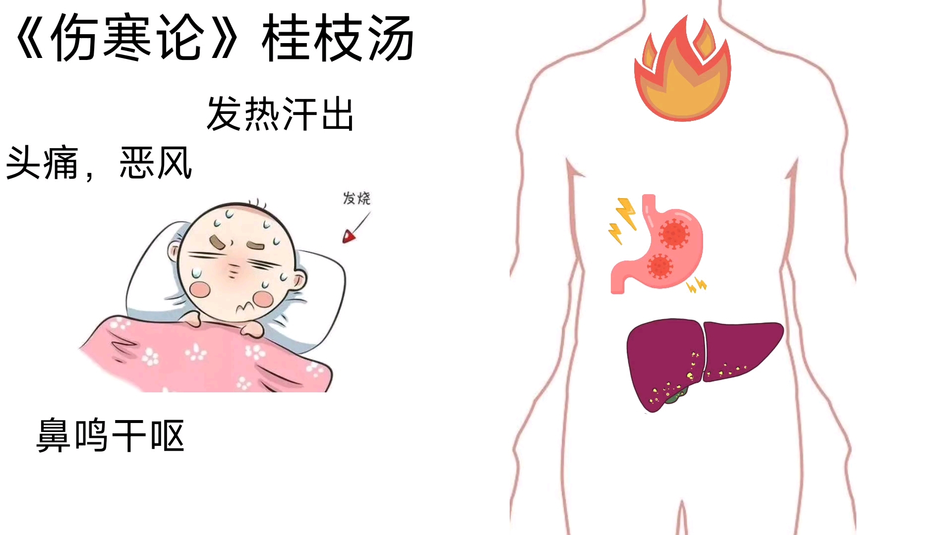 《伤寒论》桂枝汤,为何要用白芍