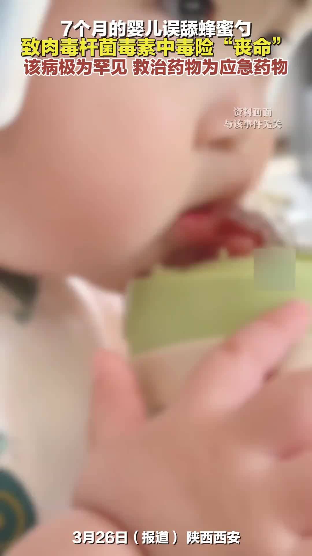 陕西西安,7个月的婴儿误舔蜂蜜勺,致肉毒杆菌毒素中毒险