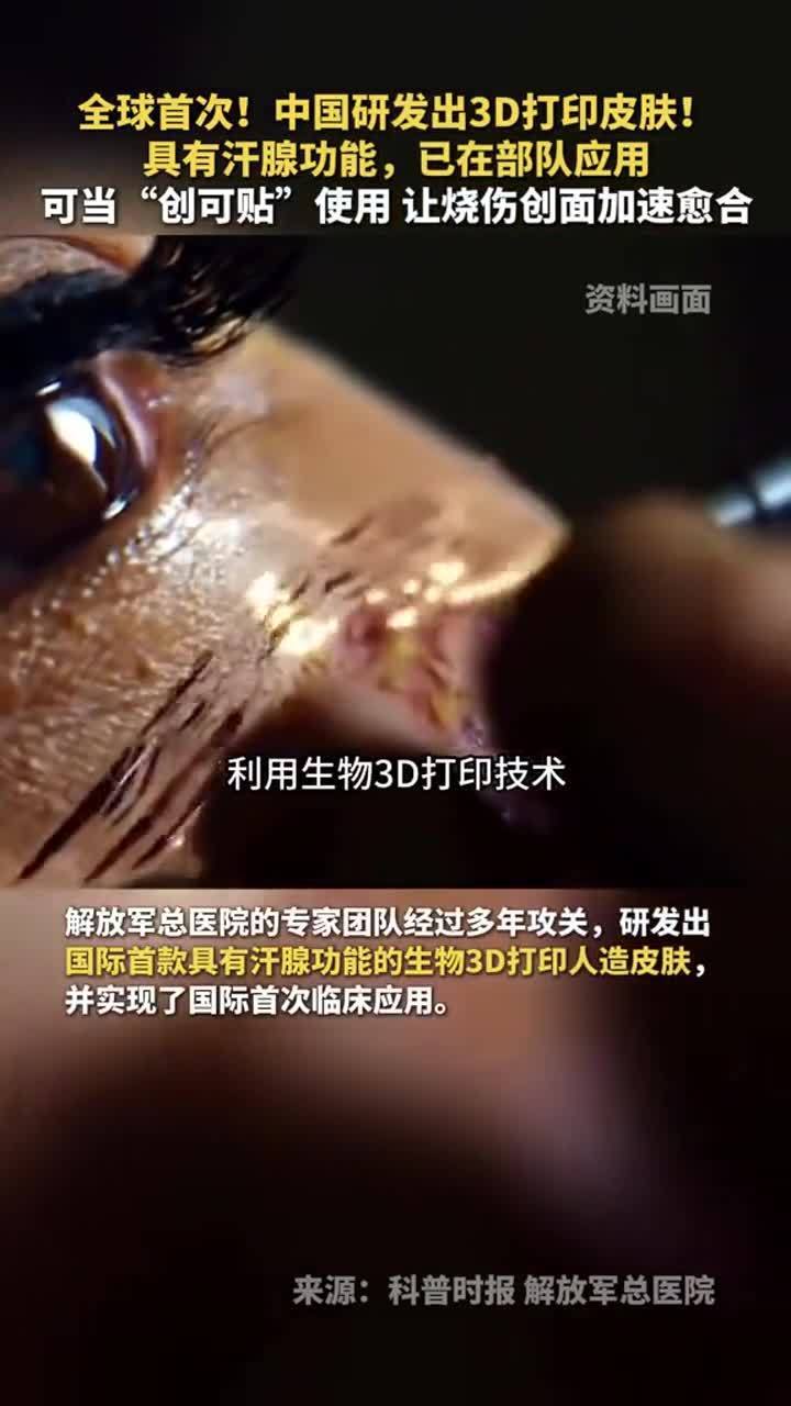 全球首次!中国研发出3D打印皮肤!具有汗腺功能,已在部队应用