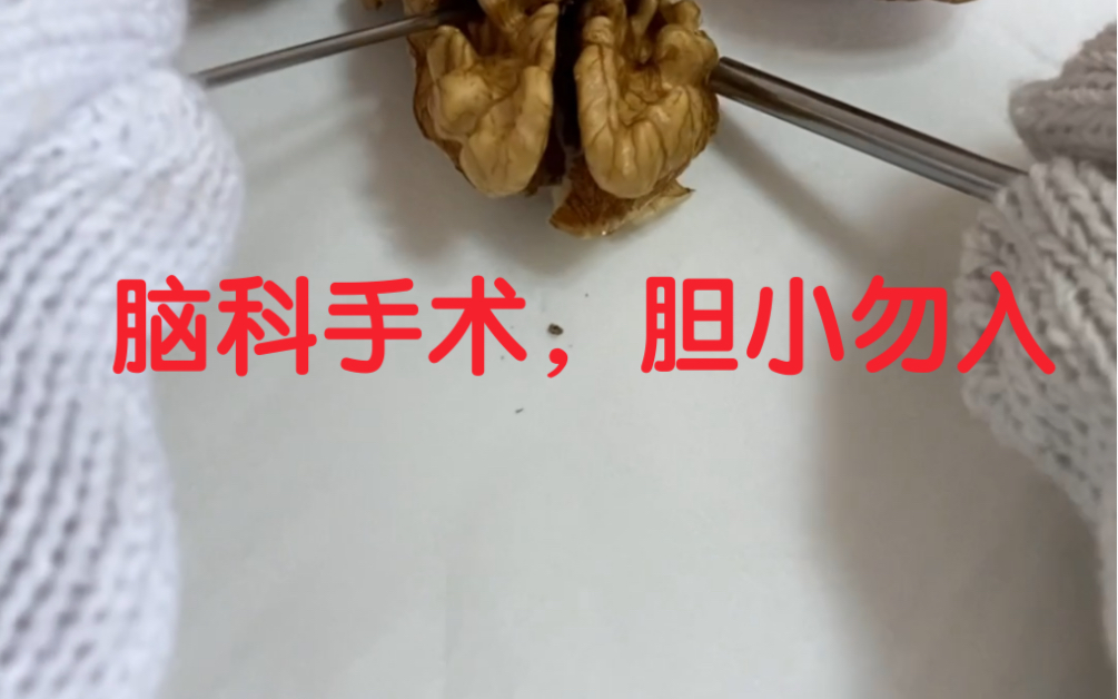 脑科手术实录!胆小者勿入,我们尽全力抢救它的大脑