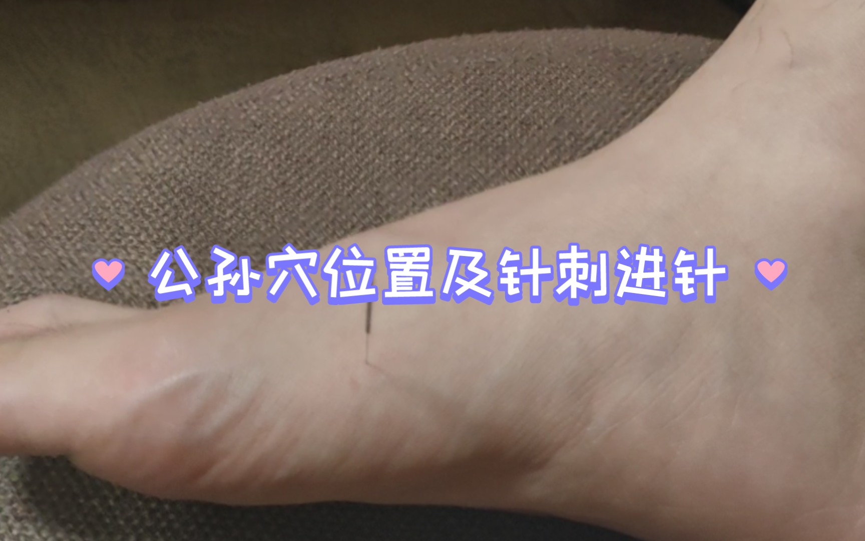 公孙穴位置及针刺进针
