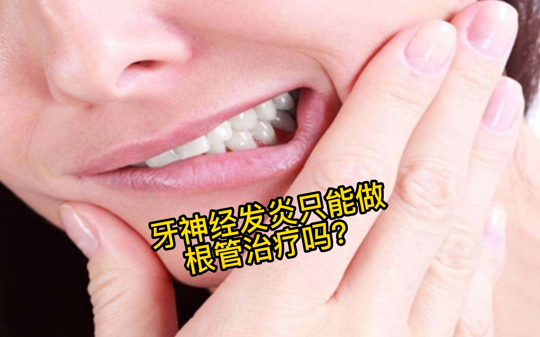 牙神经发炎只能做根管治疗吗?