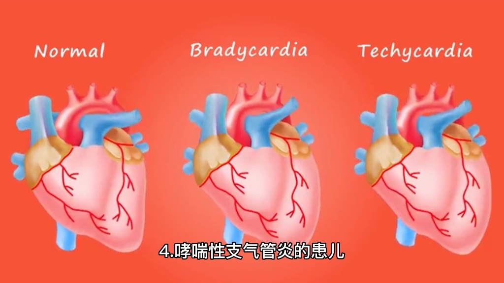 急性支气管炎的护理措施