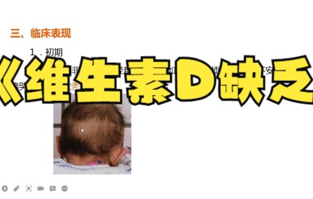 内分泌-第九节-维生素D缺乏性佝偻病