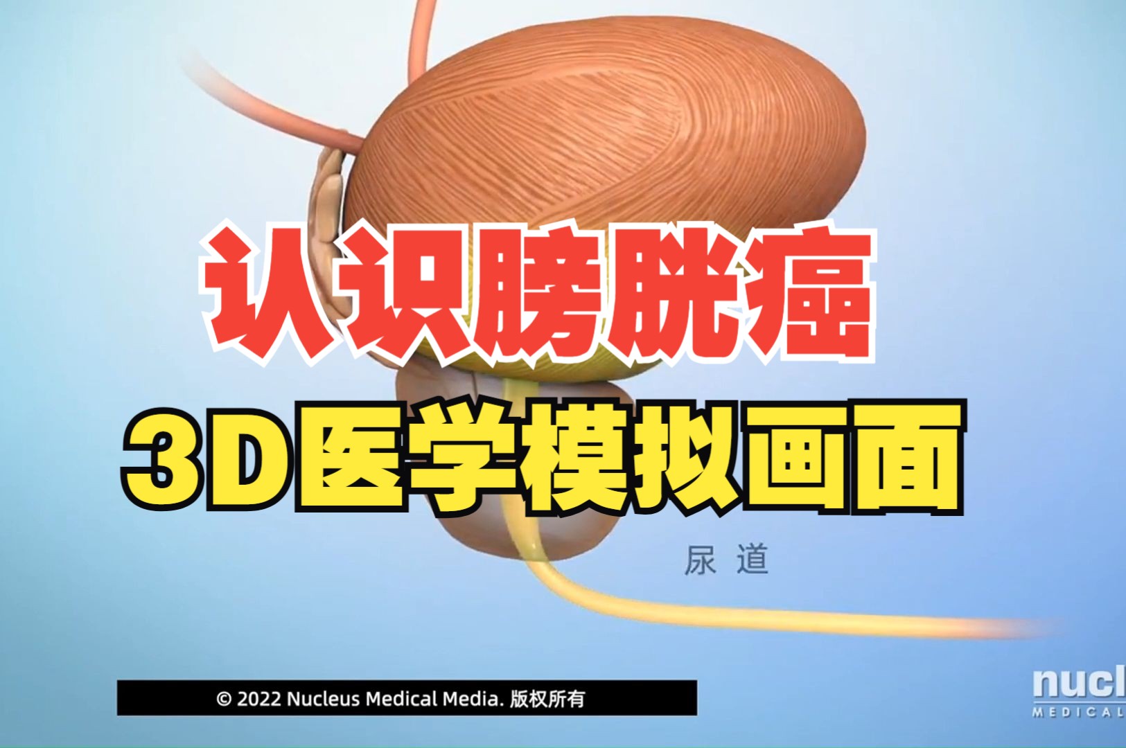 认识膀胱癌!3D科普动画(nucleus医学科普视频系列)中文