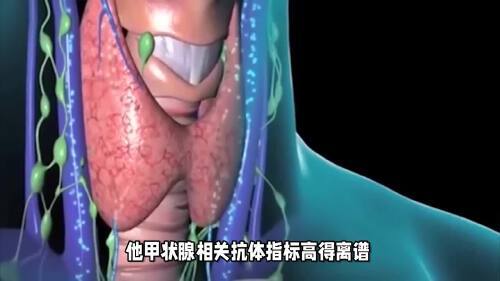 甲状腺克星!硒酵母片真能摆脱折磨?医生揭秘真相