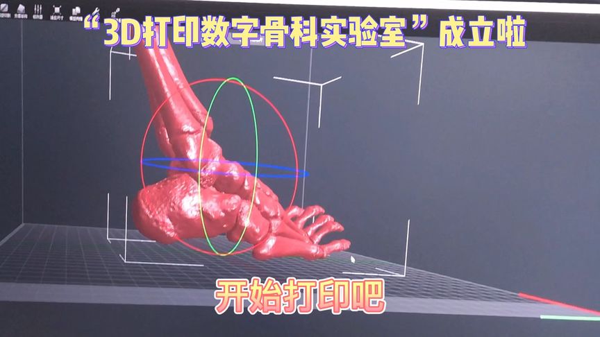 炫酷的3D打印模型来了,高精尖的设备将更好地为患者服务!