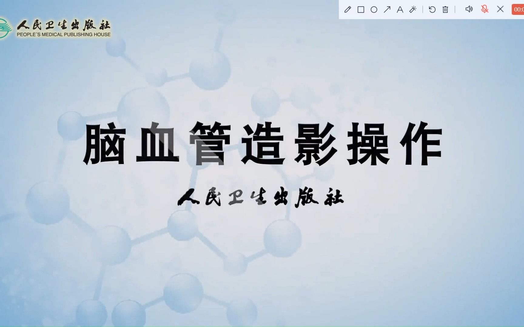 【学习自用】脑血管造影操作