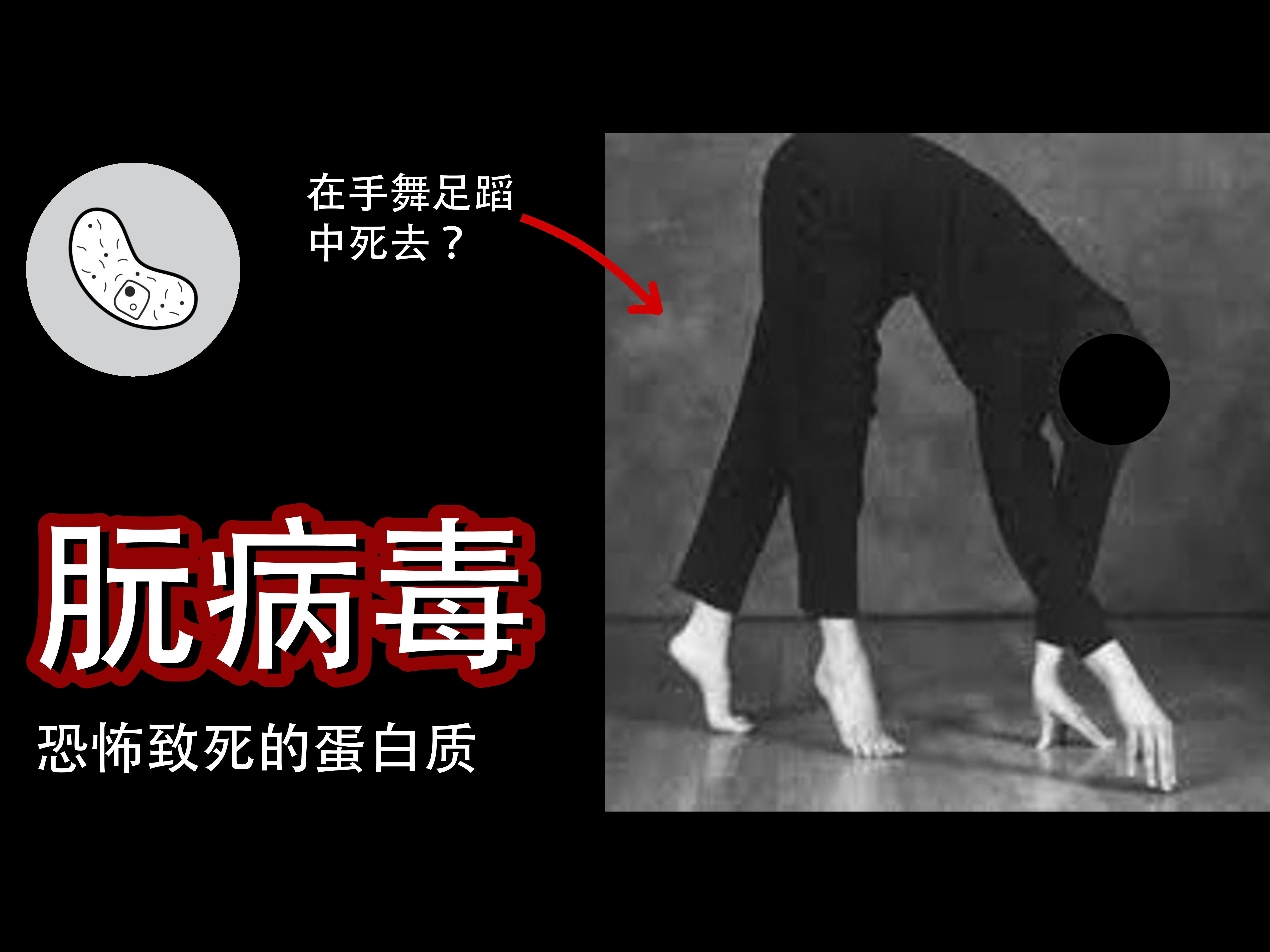 【100%致死的蛋白质】打破自然常规的朊病毒,原来你每天都在积累?...