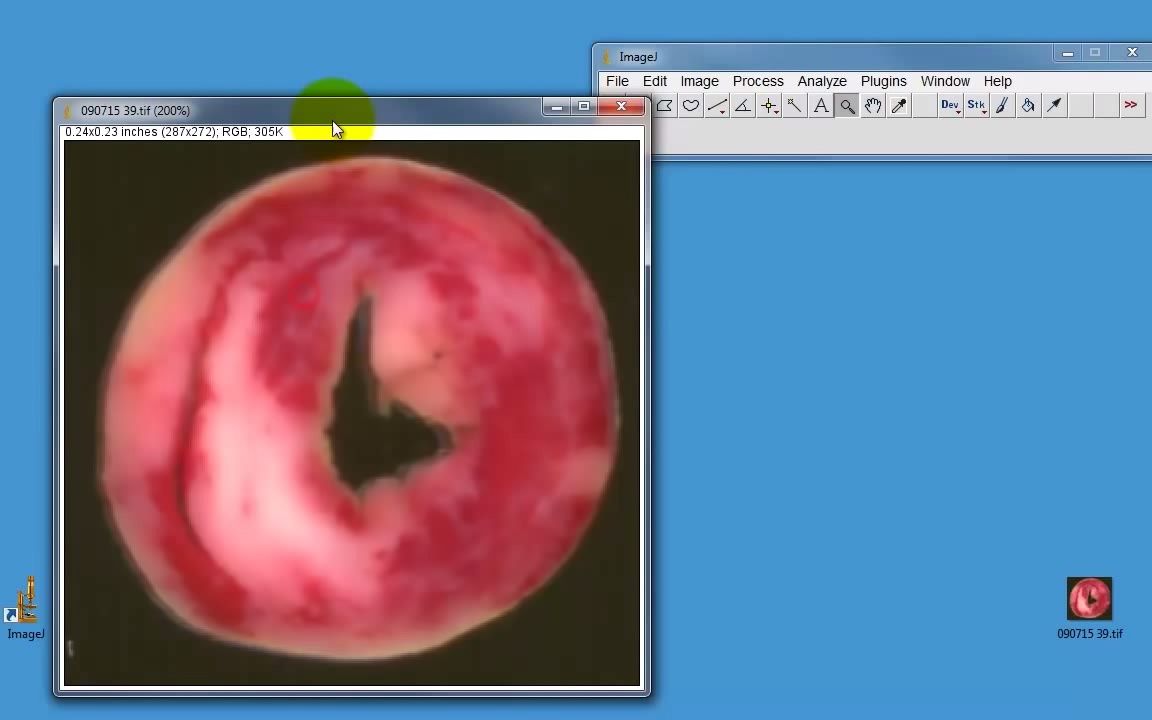 如何使用 ImageJ 测量组织学样本中的区域(中英双语字幕)