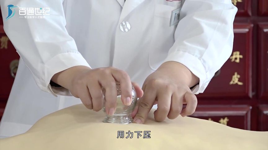 百通世纪中医实践技能之留罐法