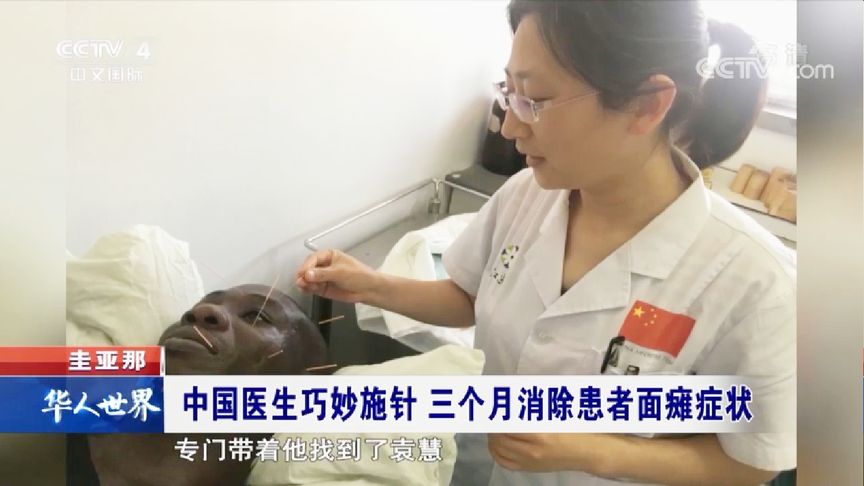 艺高人胆大!中国援外医生用针灸针代替梅花针,为患者做放血治疗
