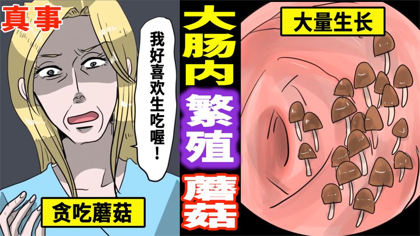 女性体内蘑菇繁殖的悲惨体验…若吃法不对 会在肚子里自然生长