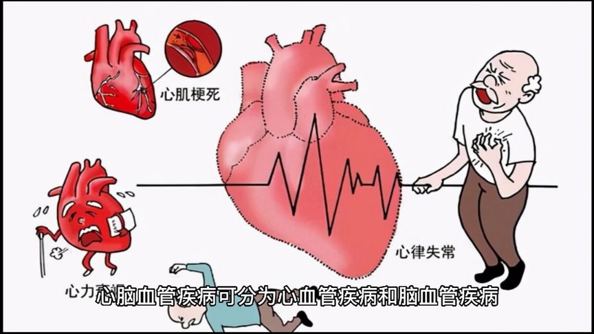 当今社会心脑血管疾病应该得道更多的宣传预防,下期继续更新