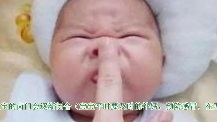 奶奶说从小捏鼻梁会让宝宝变漂亮哦,捏过的举手!