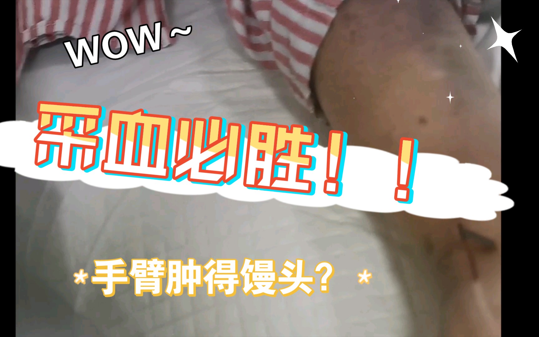 动静脉采血合集 桡动脉采血真的很简单!