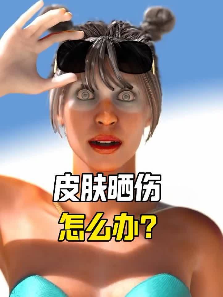 皮肤晒伤怎么办 科普冷知识 健康科普